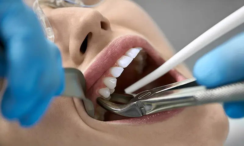 General Dentistry | Mount Hutton Dental